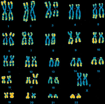 Genética humana: Cariograma